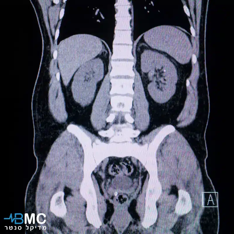 אולטרסאונד פרטי: בדיקות מהירות ומדויקות | BMC מדיקל סנטר 🩺